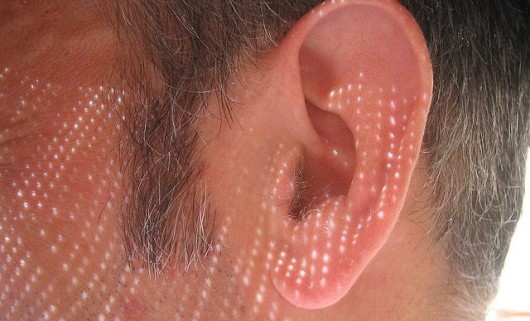 Gentle Ear Stimulation Shown to Significantly Reduce Symptoms of ...