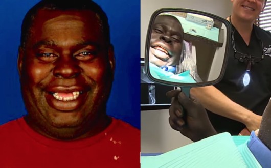 Dentist Gives Full, New Smile to Man Who Helps the Homeless - Good News ...