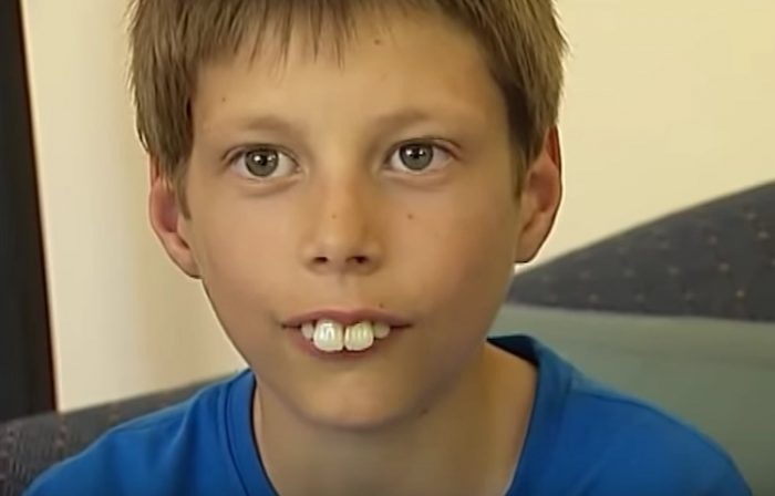 Bullied Boy With Buck-teeth Finally Gets New Smile - Good News Network