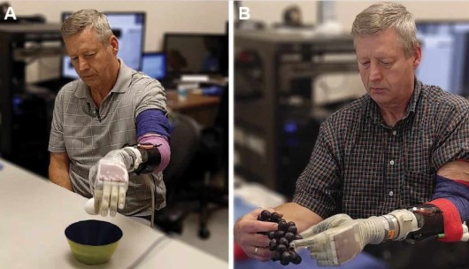 Robotic Arm Named After Luke Skywalker Enables Amputee to Touch and ...