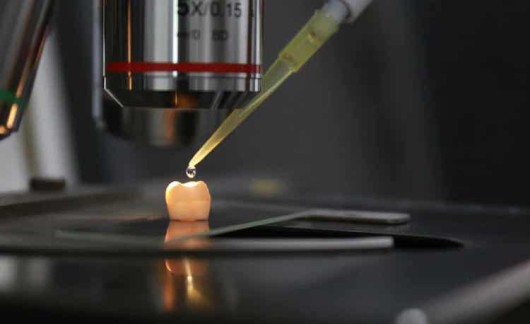 Say Goodbye to Temporary Fillings: Scientists Successfully Use a Gel to ...