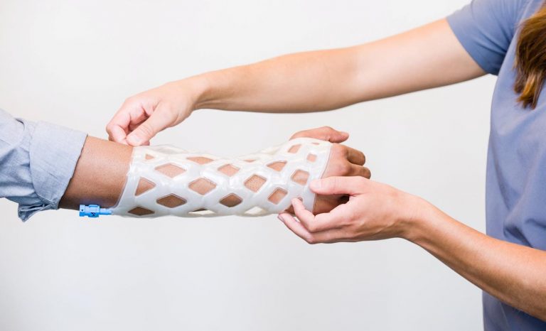 Revolutionary New Arm Cast is Waterproof, Breathable, and Itch-Free
