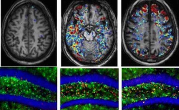 Healing Dose of Optimism: The Top 10 Medical Breakthroughs of 2019 Will ...