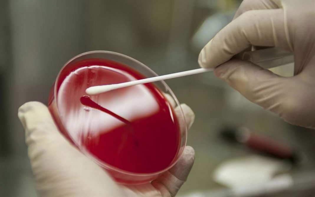 Simple Test for Children with Sinusitis Could Slash Antibiotic Use