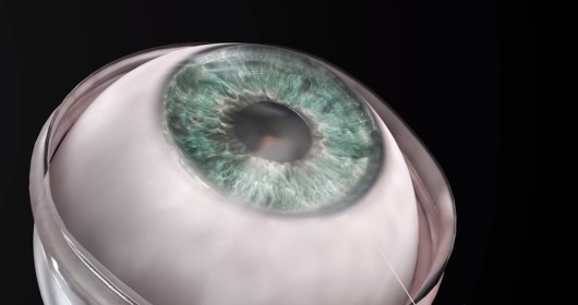 Man Regains Sight And Sees His Family Again After Becoming First Person ...