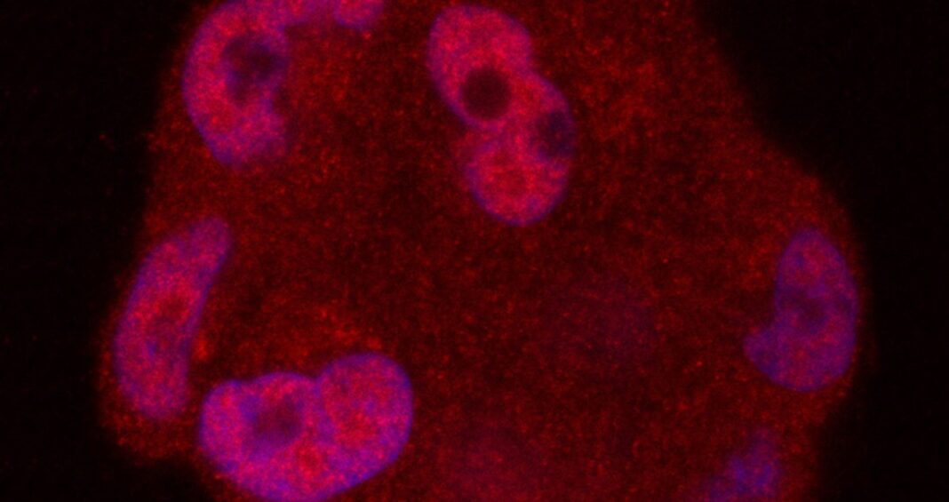 Prostate Cancer Breakthrough: Protein That Stops Tumor Growth is Discovered