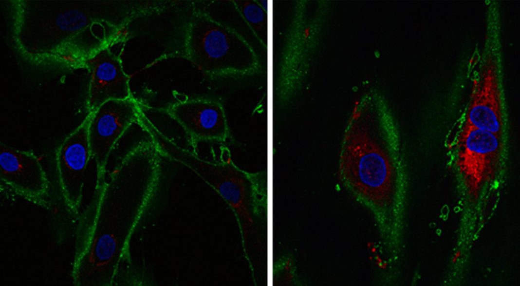 Scientists Rewind the Age of Skin Cells by 30 Years – And Others Nearby ...