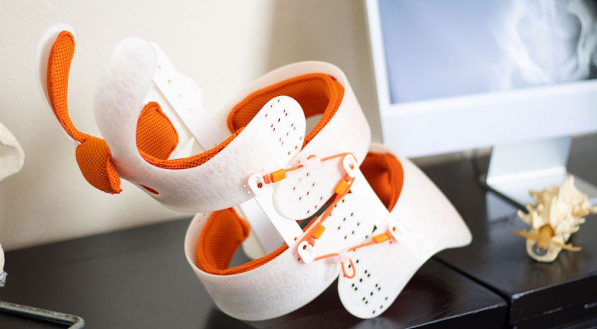 New Scoliosis Brace that Grows With Patients Wins Dyson Award For Grad ...