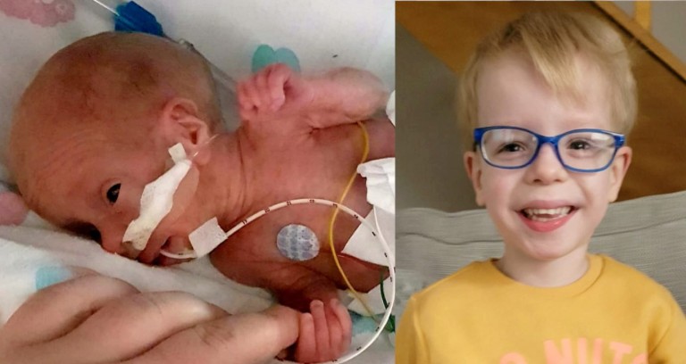 Preemie Given 10% Chance of Survival Defies the Odds and is Now ‘a ...
