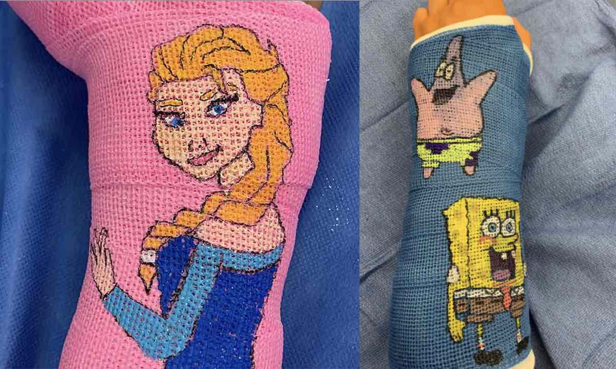 Artistic Doctor Transforms Kids’ Broken Arms Into Animated Artwork ...