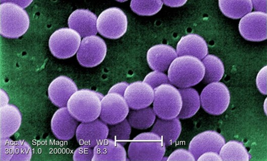 Scientists Hail New Antibiotic That Can Kill Drug-Resistant Bacteria