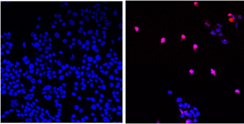 Molecule that Kills Most Solid Cancer Tumor Cells Leaving Others ...