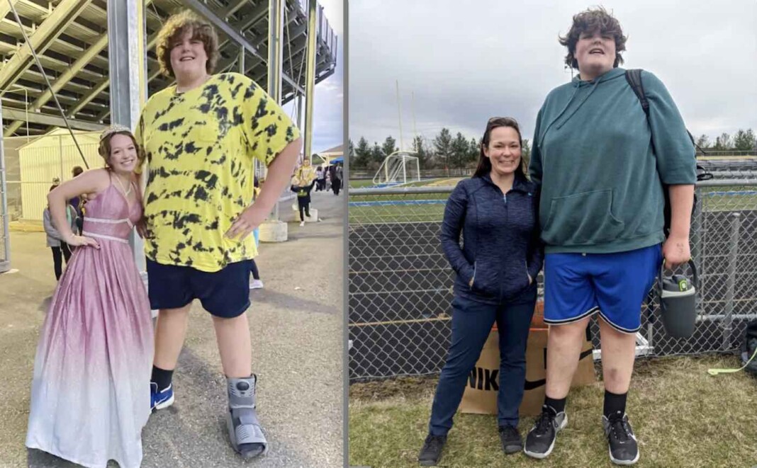 Viral Teen With Record Size Feet Finally Gets Size 23 Shoes Donated So ...