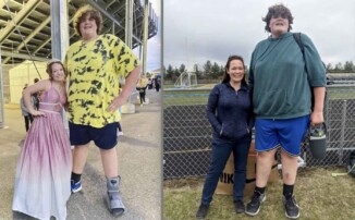 Viral Teen With Record Size Feet Finally Gets Size 23 Shoes Donated So ...