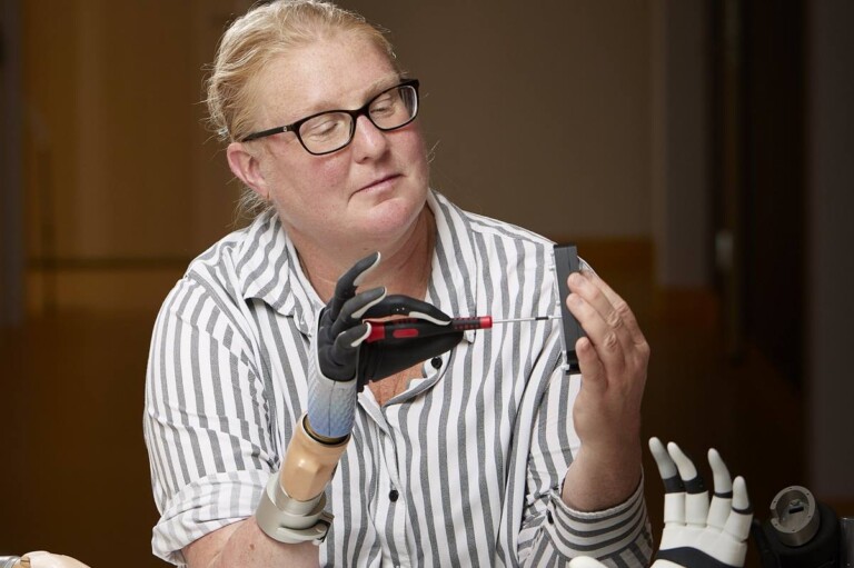 Woman Becomes First Human to be Fitted with Nerve and Bone Fused Bionic ...