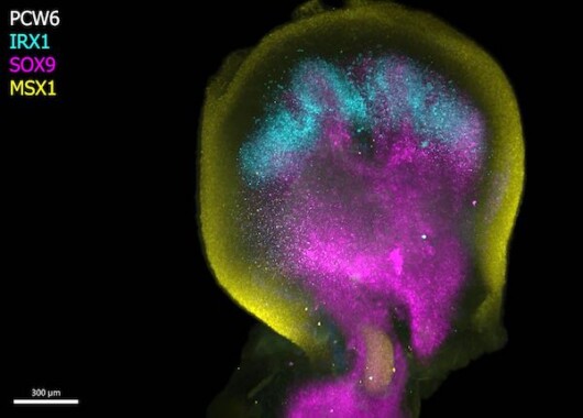 First Remarkable Mapping of Limb Development Shows Stages of Creating ...