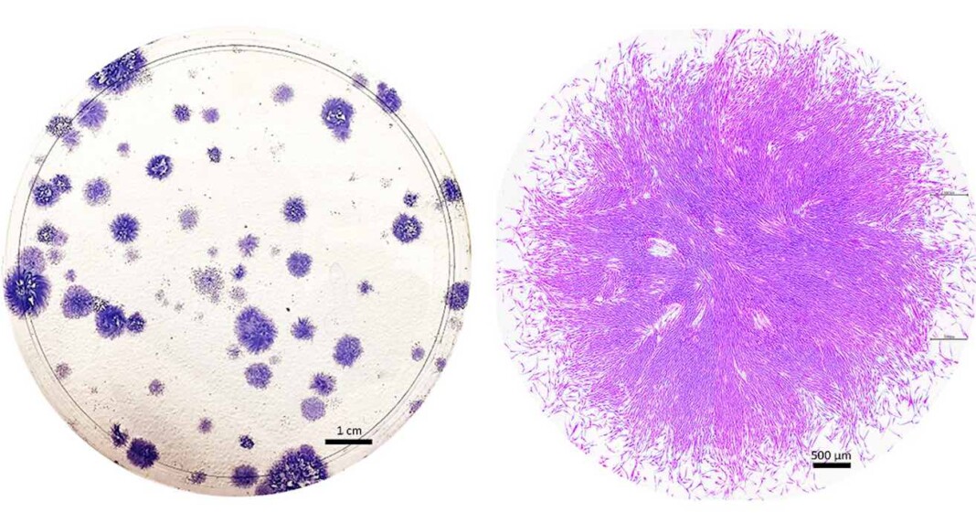 Stem Cells in Menstrual Blood Have Thrilling Potential for Health ...