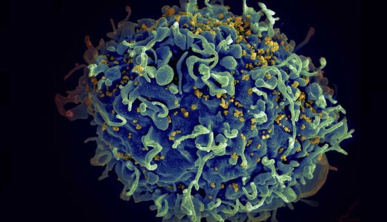 Scientists Discover Potential HIV Cure that Eliminates Disease from ...