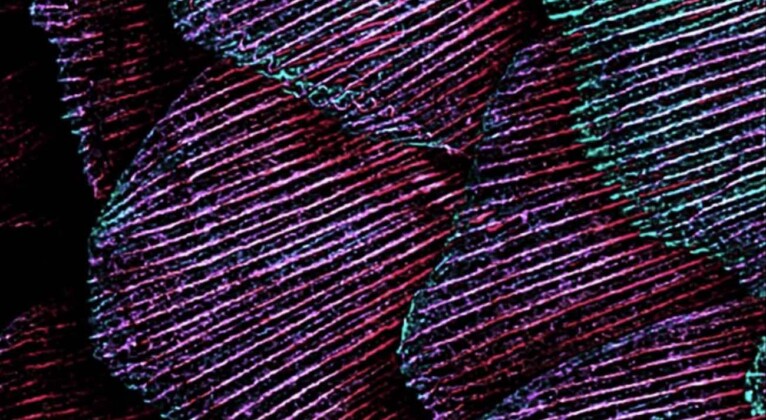 Secret of How Butterfly Wings Get Their Vibrant Colors Is Discovered
