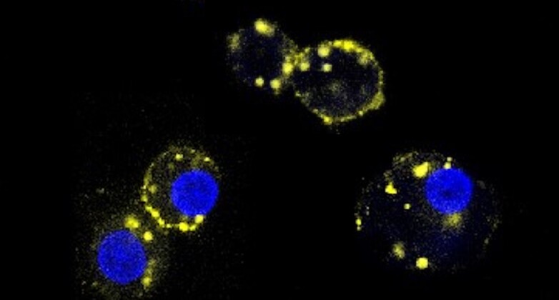 Experimental Type 1 Diabetes Drug Shields Pancreas Cells from the Usual ...