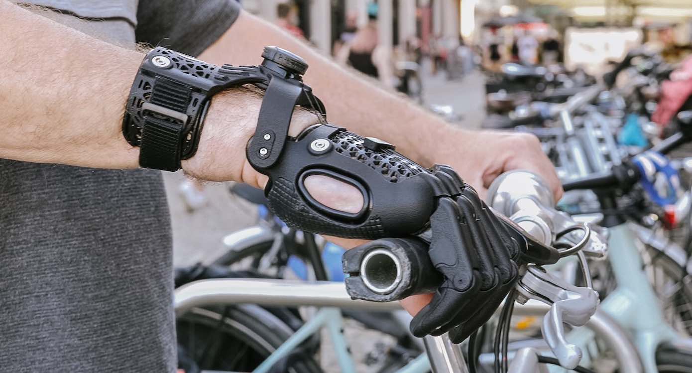 Man Injured in Work Accident Gets 3D-Printed Fingers – A Glove That ...