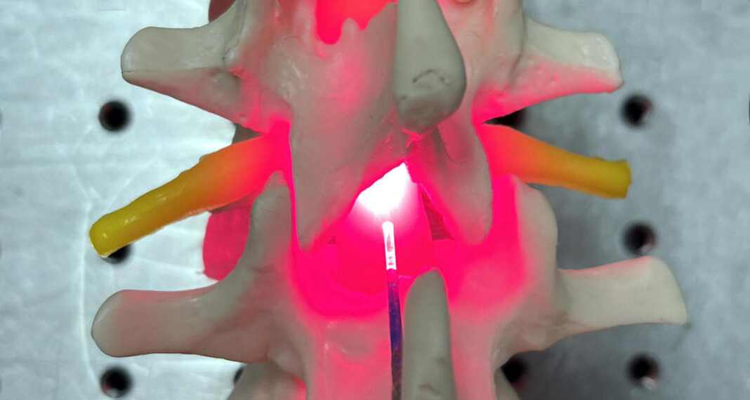 Red Light Therapy for Repairing Spinal Cord Injury Reaches Milestone ...