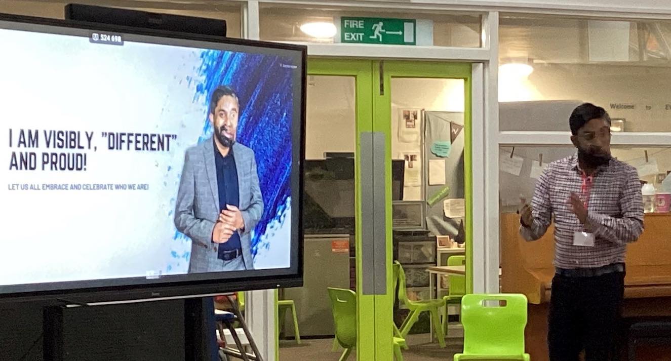 Bullied Man With Facial Disease Quits Job to Speak to Schools And Help ...