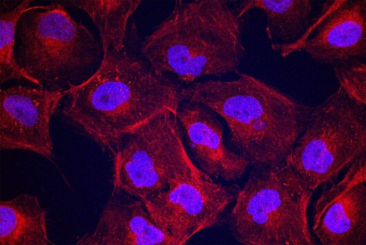 Nanofiber Molecules Help Repair Cartilage Damage in Joints by ...