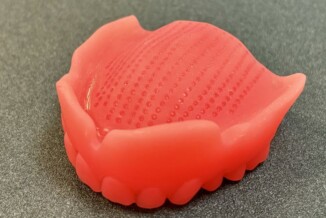 Octopus Suction Cup Design Could Help Dentures Stick to the Mouth