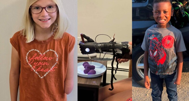 Insurer Denies Prosthetic So Family Crowdfunds $30k–But Angel Steps In ...