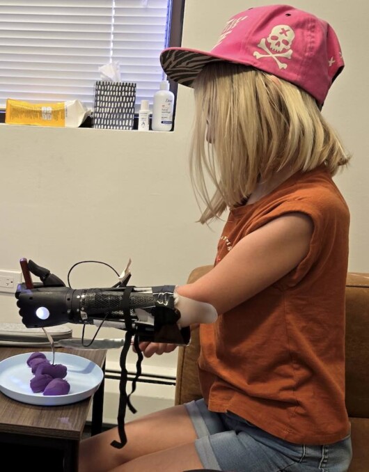 Insurer Denies Prosthetic So Family Crowdfunds $30k–But Angel Steps In ...