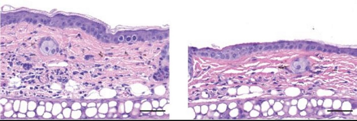 Itching Solution: New Approach Could Treat Inflammatory Skin Conditions ...