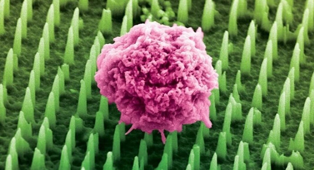 Needles 1,000 Times Thinner than a Hair to Replace Painful Cancer Biopsies