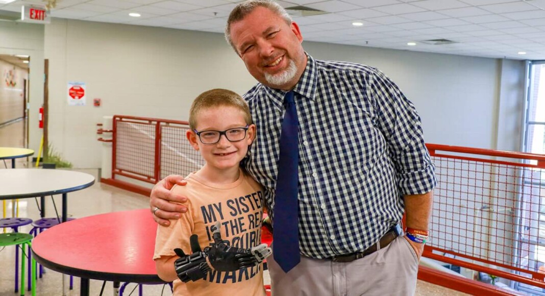 Kentucky Teacher-of-the-Year Created a Prosthetic Hand for a Student ...