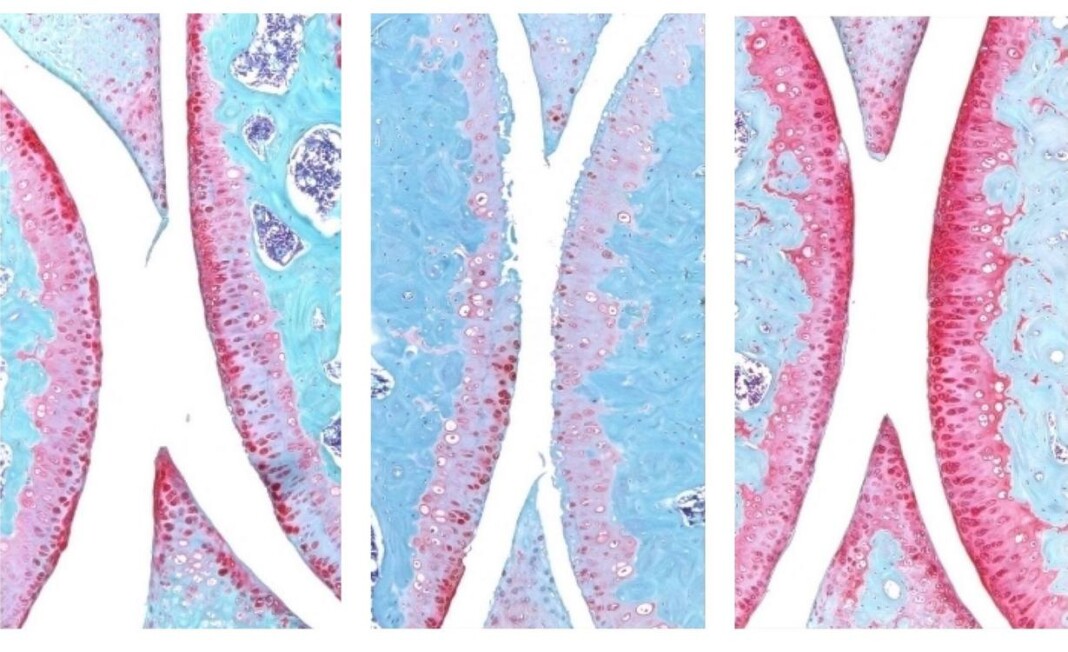 Anti-Aging Drug Regrows Knee Cartilage in Major Breakthrough That Could ...